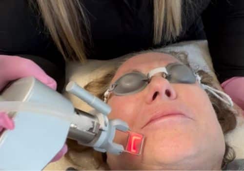 CO₂ Laser Milwaukee | EvolvMD MedSpa– Skin Resurfacing