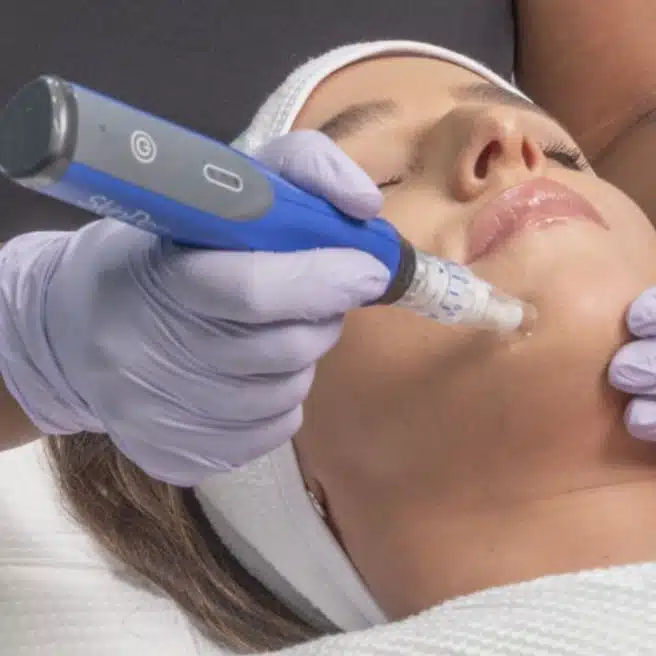 SkinPen Precision Elite Microneedling at EvolvMD Milwaukee | Transform ...